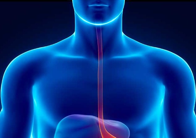 Usan técnica que trata una enfermedad del esófago sin necesidad de ...